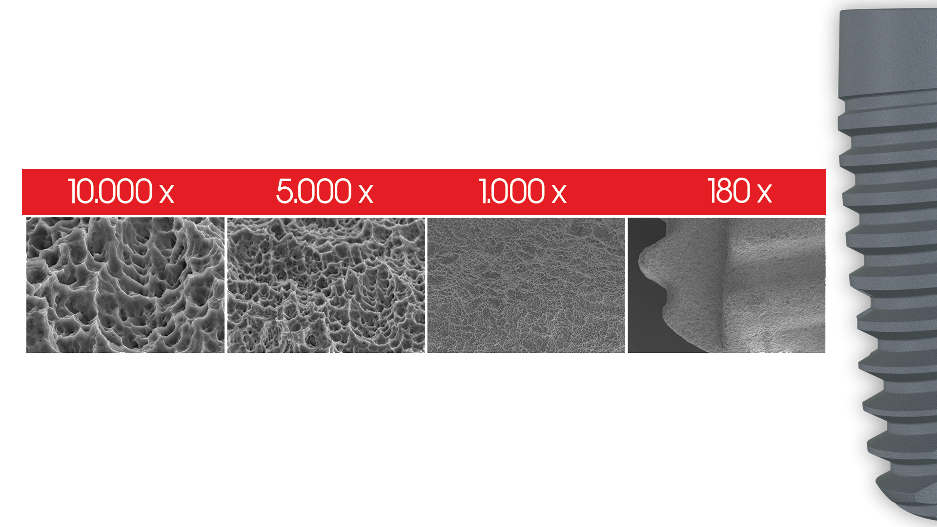 Dentcon Implant Systems – Powered by Innovation